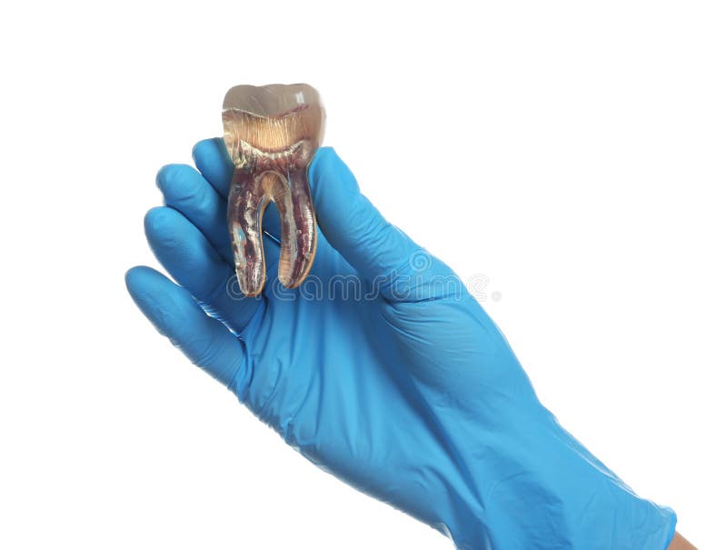 Dentist Holding Educational Model of Tooth in Hand on White Stock Photo ...
