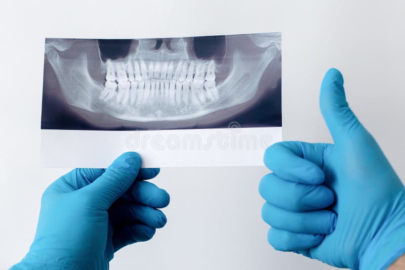Dentist Holds Photo of Teeth in His Hands Stock Image - Image of heal ...