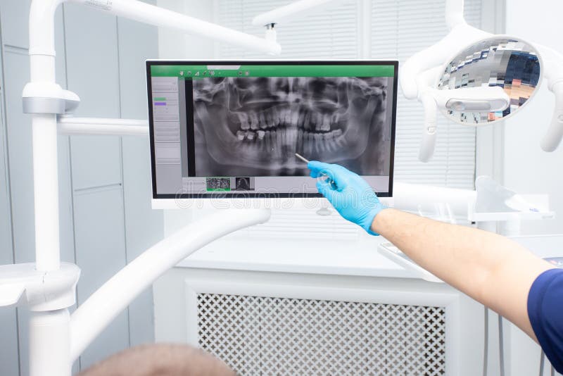 Dentist Looking Teeth on Digital X-Ray Computer Monitor Stock Photo ...