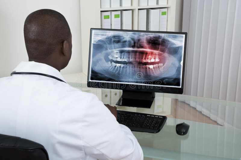 Dentist Looking at Teeth X-ray on Computer Stock Image - Image of ...