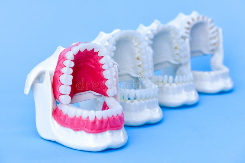 Dentist Orthodontic Teeth Models Stock Photo - Image of medical, care ...