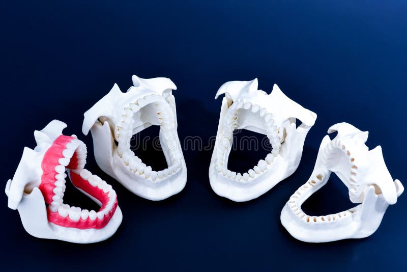 Dentist Orthodontic Teeth Models Stock Image - Image of equipment ...