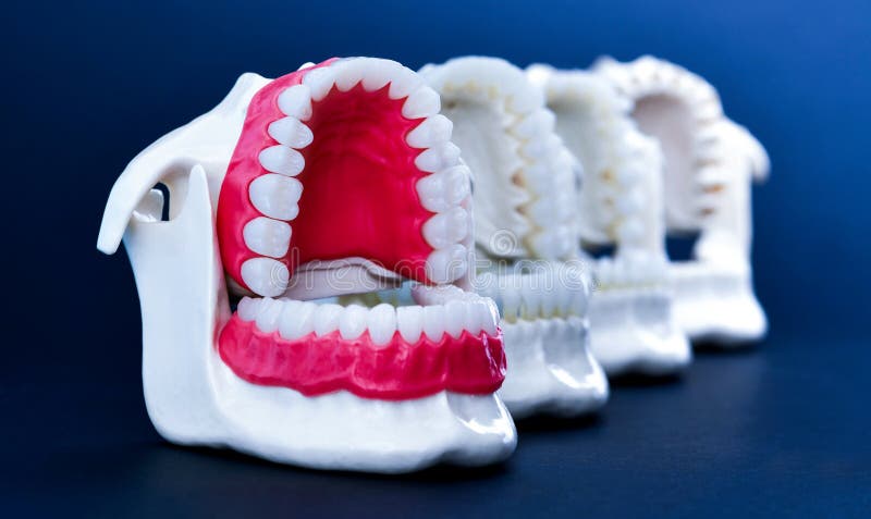Dentist Orthodontic Teeth Models Stock Photo - Image of education ...