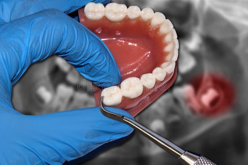 Dental Occlusion Molars Teeth Close Up Stock Photo - Image of ...