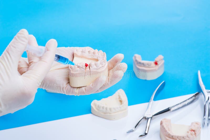 Dentist Shows How To Do the Injection Stock Photo - Image of dentist ...