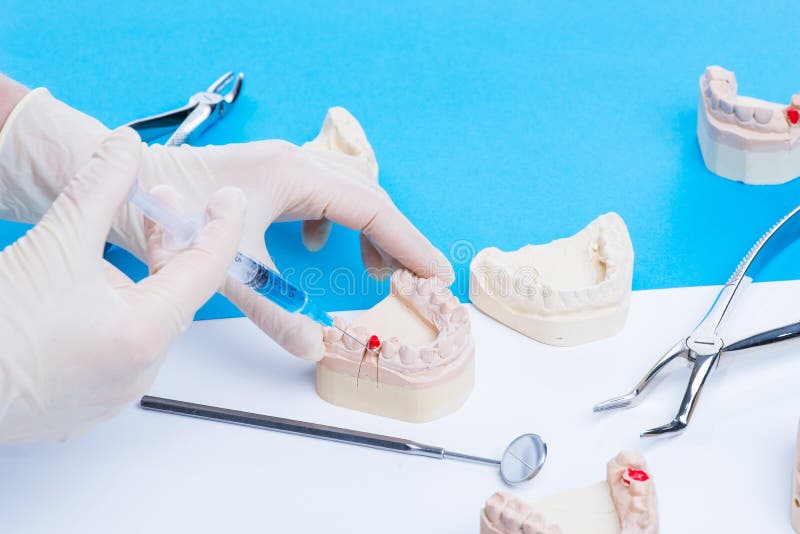Dentist Shows How To Do the Injection Stock Photo - Image of medicine ...