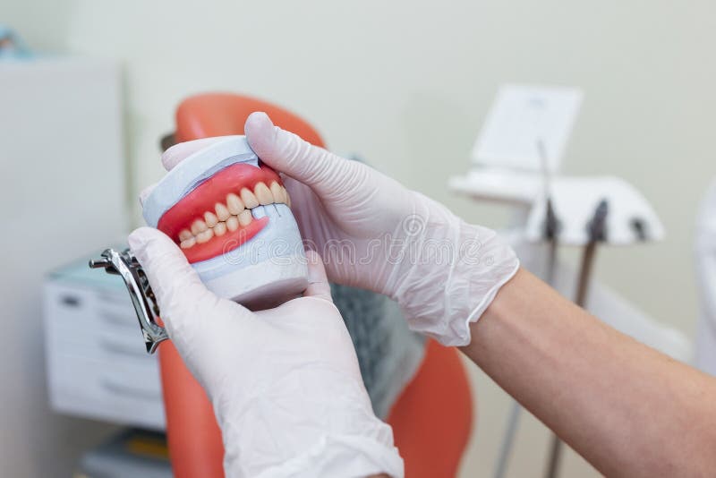Dentist Shows the Patient a Model of the Jaw and Teeth Stock Photo ...