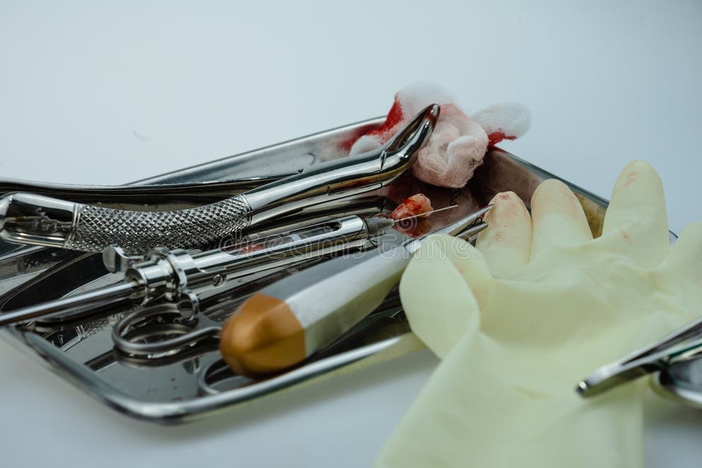 Dentist Tools - Surgical Extraction of Wisdom Tooth Stock Image - Image ...