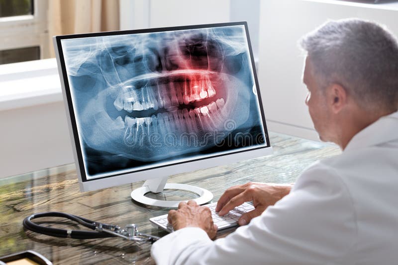 Dentist Typing on Computer with Dental X-ray on Screen Stock Image ...