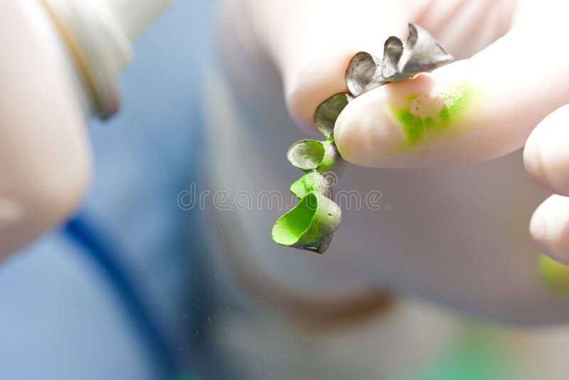Dentist Using Occlusal Spray on Fixed Denture Stock Image - Image of ...