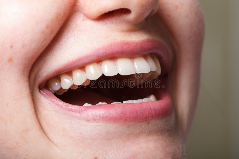 Dentistry, Dental , Mouth and Teeth Close Up Smiling Stock Photo ...