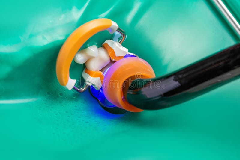 Dentistry, Dental Treatment Using Various Devices. Stock Photo - Image ...