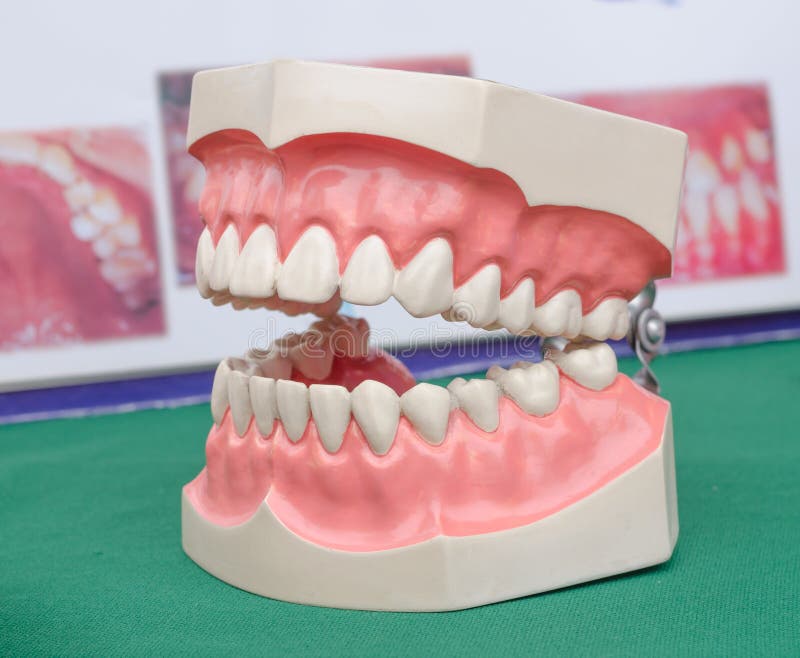 Dentoform, Dental Teeth Model Stock Image - Image of incisive, clean ...