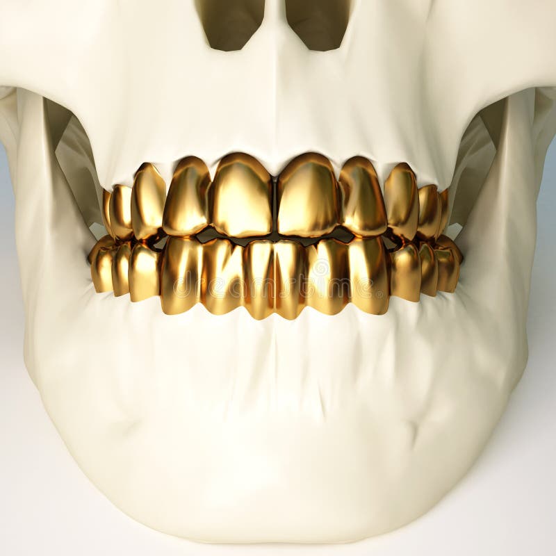 Dents d'or et d'argent photo stock. Image du dentaire - 10903298