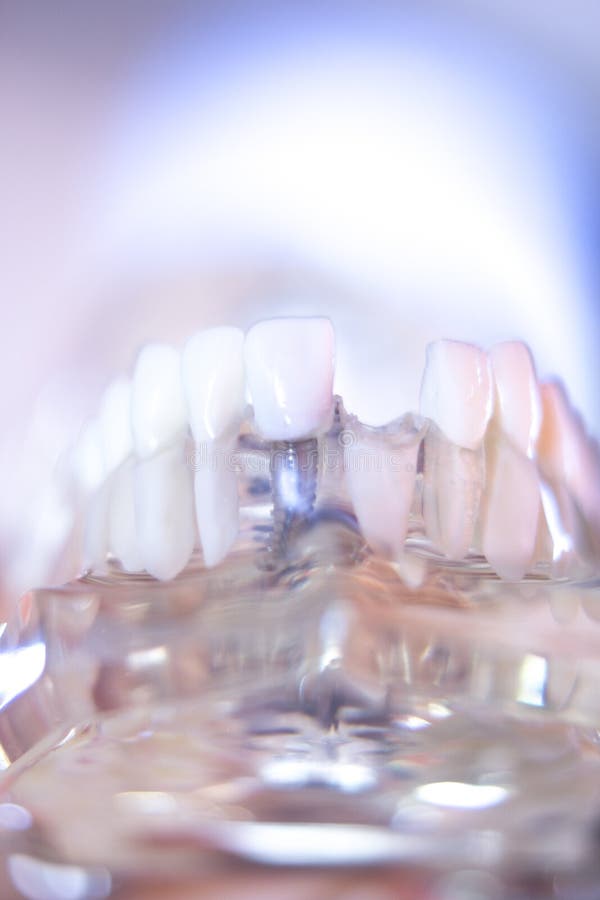 Tand- mellanrum fotografering för bildbyråer. Bild av close - 20032049
