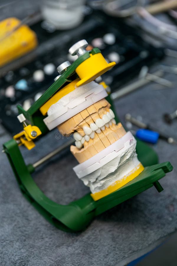 Denture Layout. Technician Corrects Bite on a Dental Layout Stock Photo ...