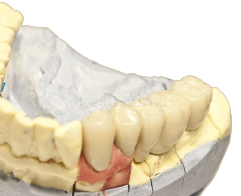 Denture Model Picture. Image: 18897753