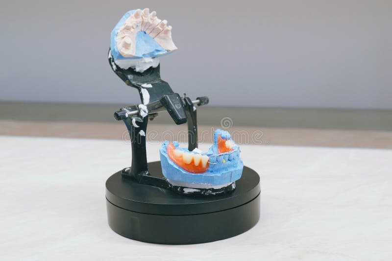 Denture Model Displaying Dental Craftsmanship in a Lab Stock Image ...