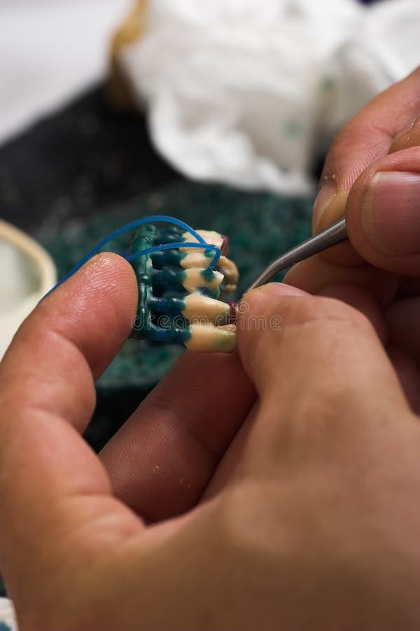 Denture mold stock photo. Image of clean, blue, smoothing - 3136728