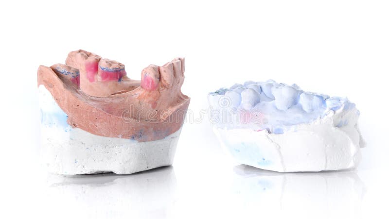Denture Mold,broken Tooth on White Background. Stock Image - Image of ...