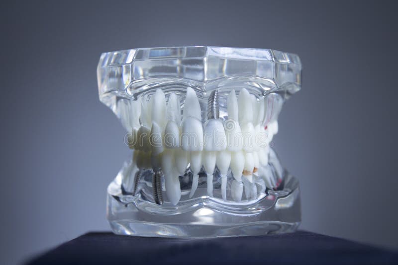 Denture for Students Transparent Stock Photo - Image of isolated ...