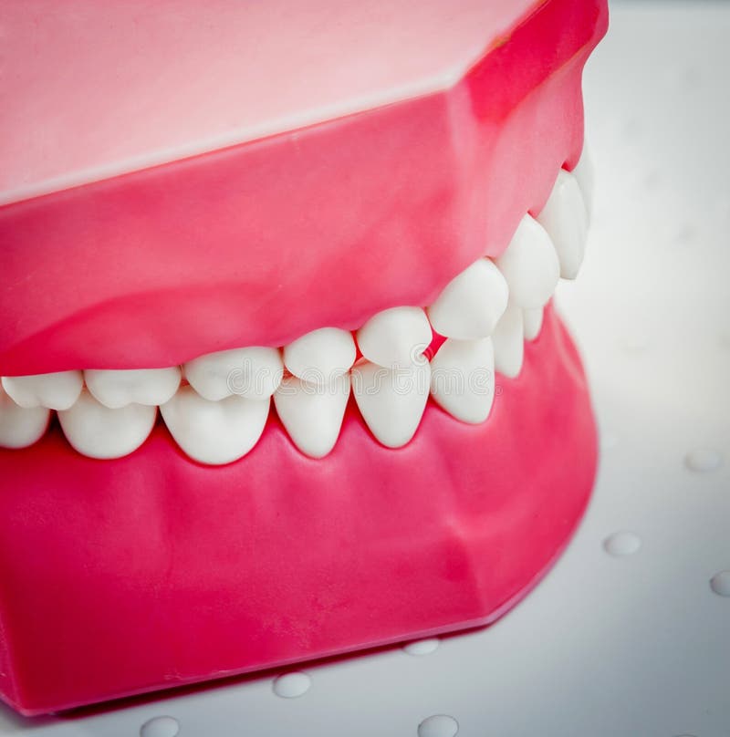 Set of Dentures is on Table in Dental Office Concept Stock Photo ...