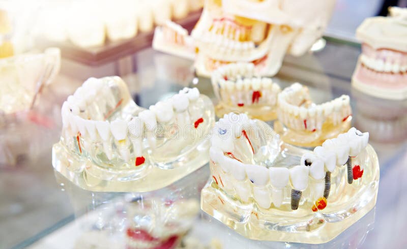 Dentures Teeth Dummies in Dental Store Stock Photo - Image of human ...