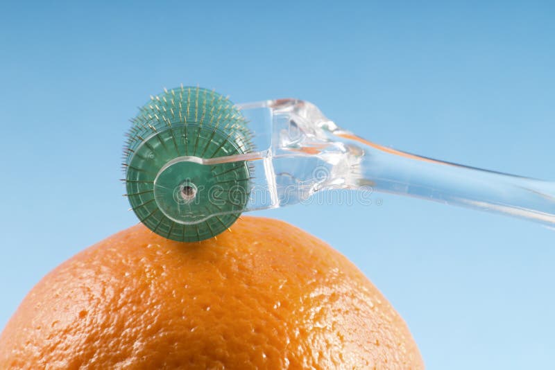 Dermaroller Voor Medische Micro- Needling Therapie Stock Foto - Image ...