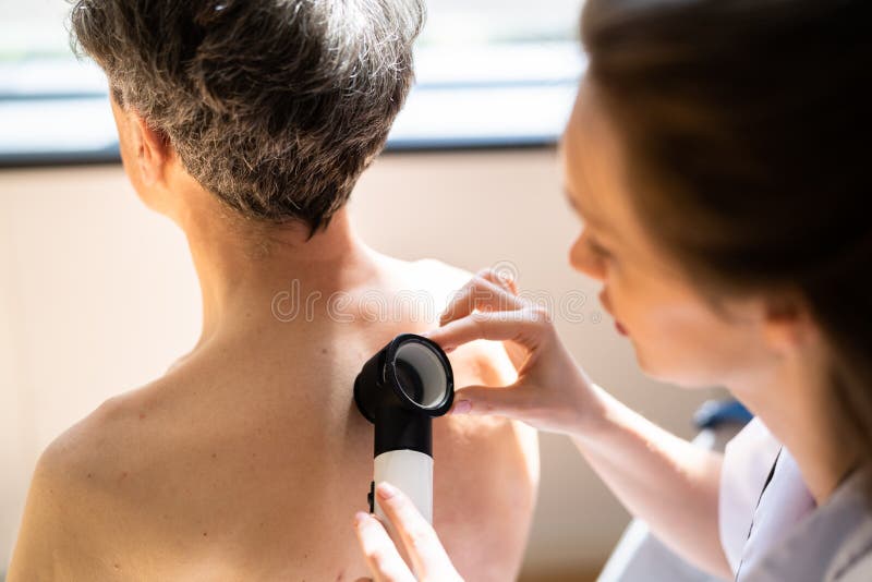 Dermatologist Checking Skin Allergy Stock Photo - Image of patient ...