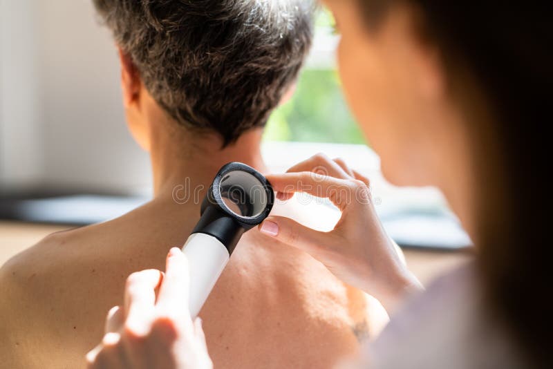 Dermatologist Checking Skin Allergy Stock Photo - Image of ...