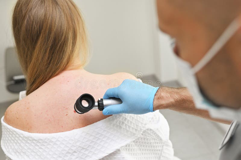 Dermatologist Examines Neoplasms On The Patientand X27 S Skin Using A