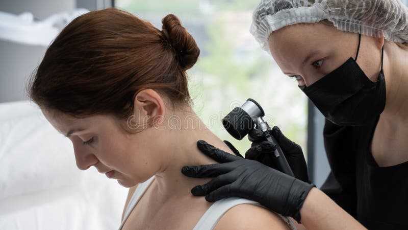 A Dermatologist Examines a Patient& X27;s Mole through a Dermatoscope ...