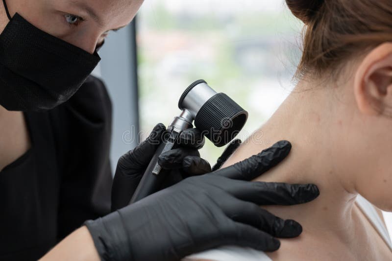A Dermatologist Examines a Patient& X27;s Mole through a Dermatoscope ...