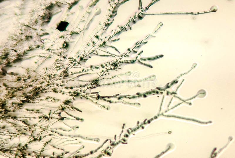 Dermatophyte Fungus Under the Microscope Stock Photo - Image of fractal ...
