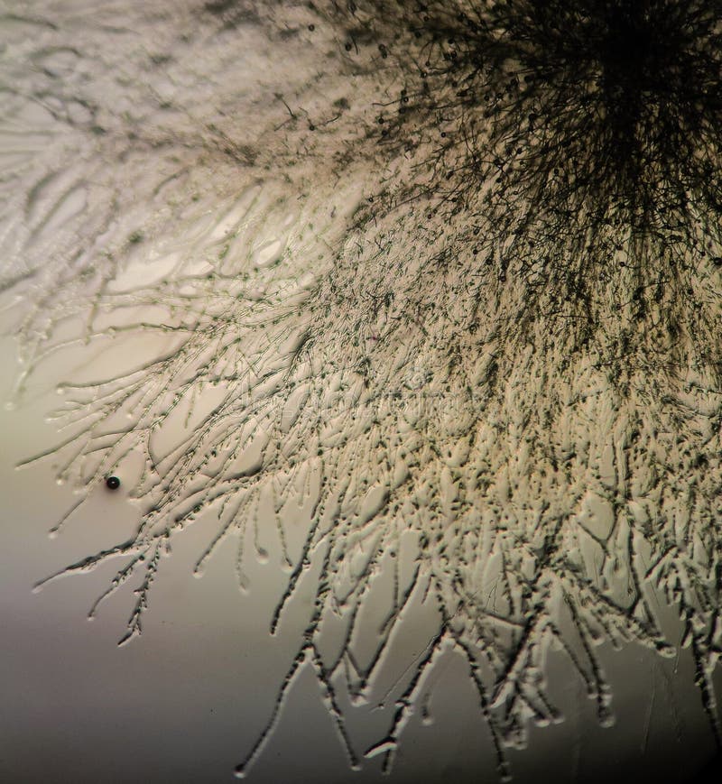 Dermatphyte Fungus Under the Microscope Stock Photo - Image of ...