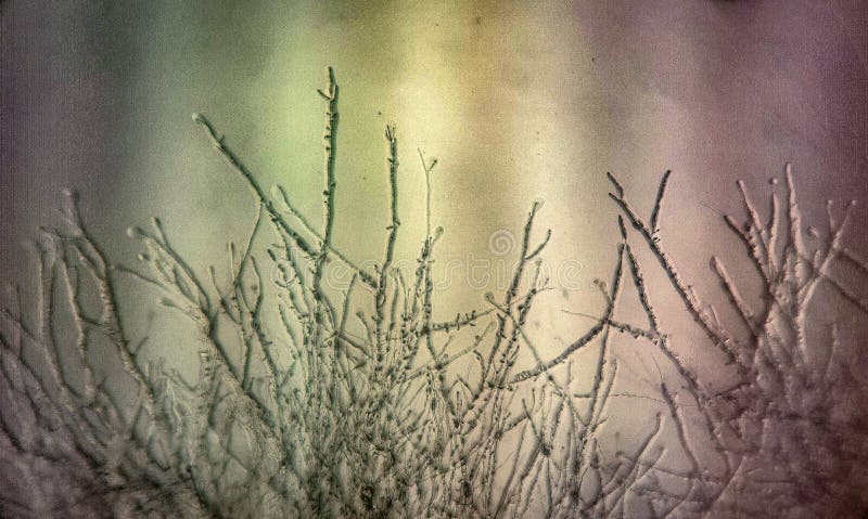 Dermatophyte Fungus Isolated from Human Skin Under the Microscope Stock ...