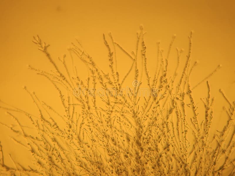 Dermatphyte Fungus Under the Microscope Stock Photo - Image of ...