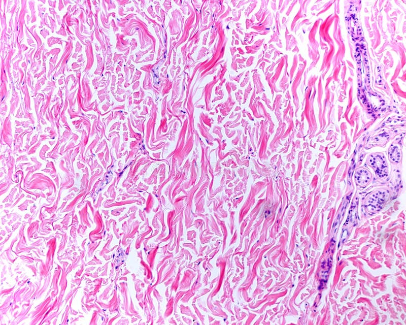 459 Histology Dermis Stock Photos - Free & Royalty-Free Stock Photos ...