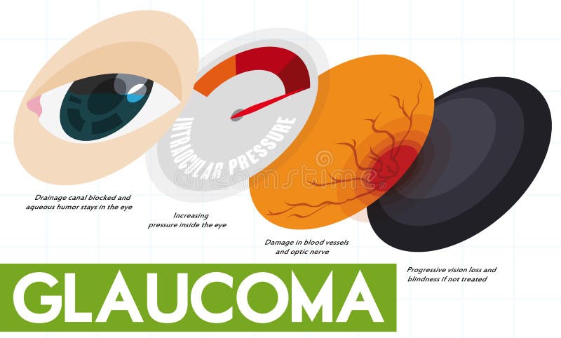 Infographic Showing Some Sarcoma Types and Principal Affected Tissues ...