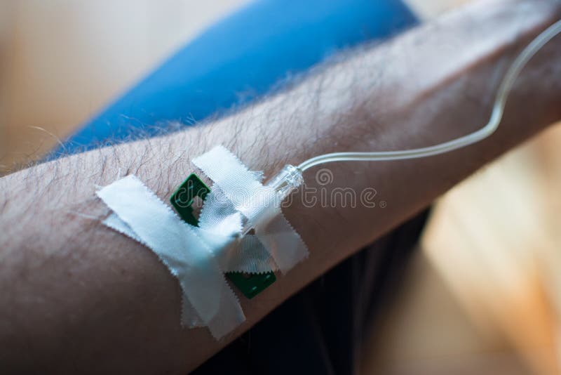 Detail of Arm with Drip Attached Stock Photo - Image of nurse ...