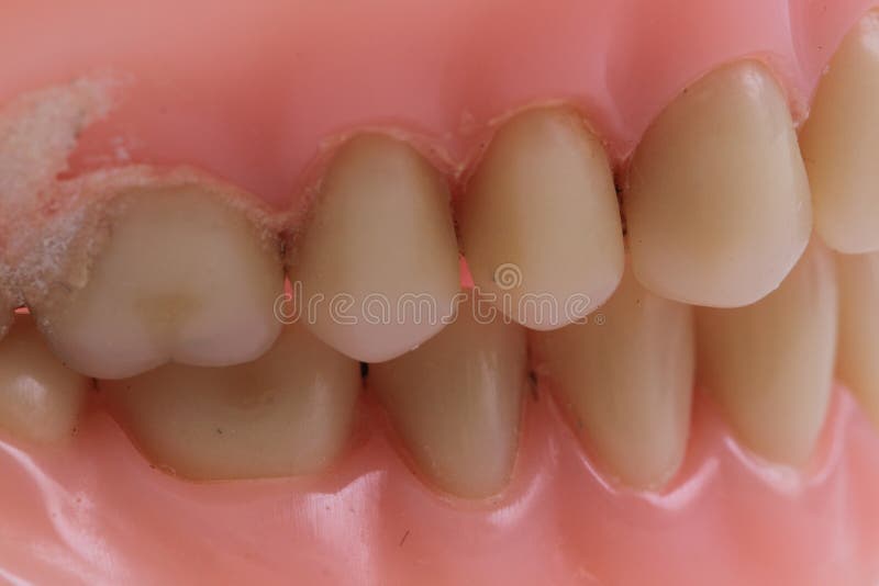 Detail plastic teeth stock photo. Image of woman, path - 78690342