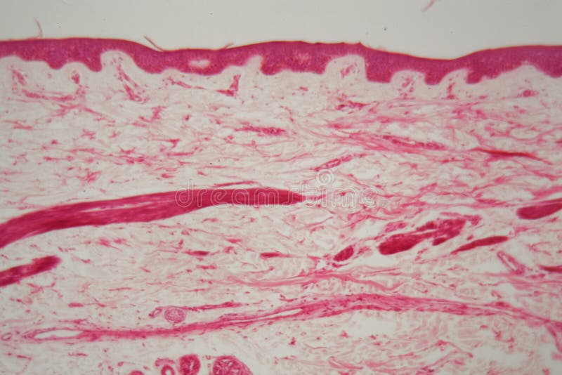Detail of Skin Under the Microscope. Stock Photo - Image of clinical ...