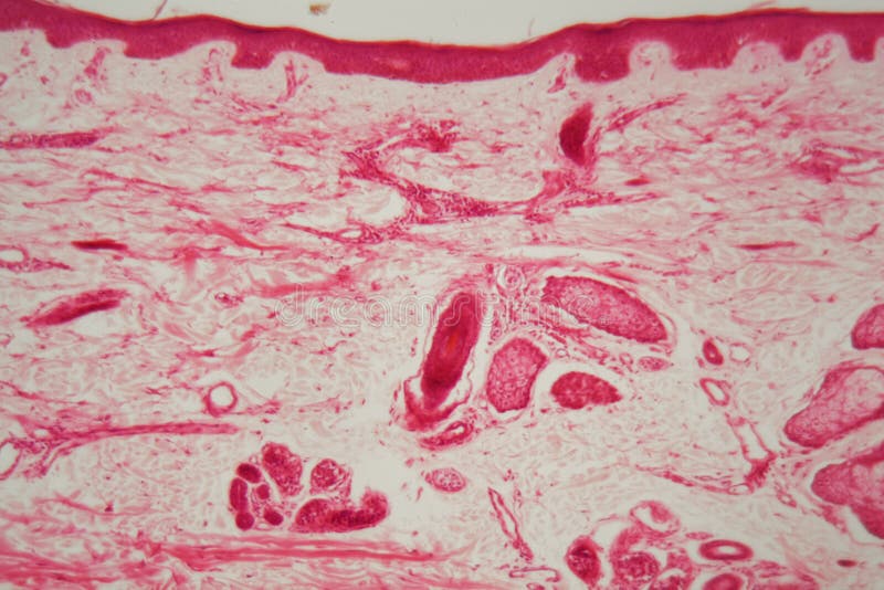 Detail of Skin Under the Microscope. Stock Image - Image of clinical ...