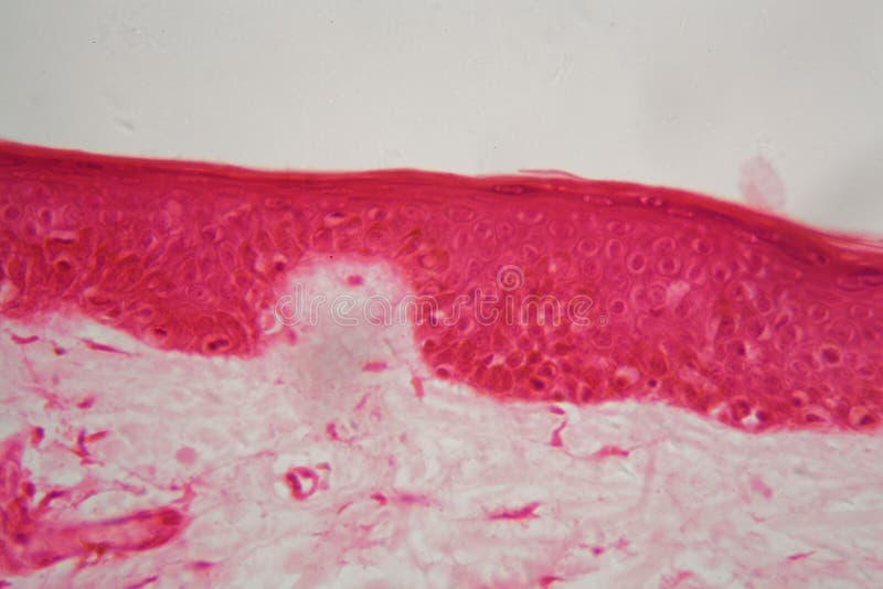 Detail of Skin Under the Microscope. Stock Photo - Image of pathology ...