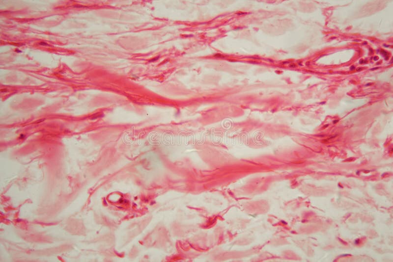Detail of Skin Under the Microscope. Stock Photo - Image of anatomy ...