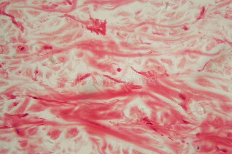 Detail of Skin Under the Microscope. Stock Image - Image of clinical ...