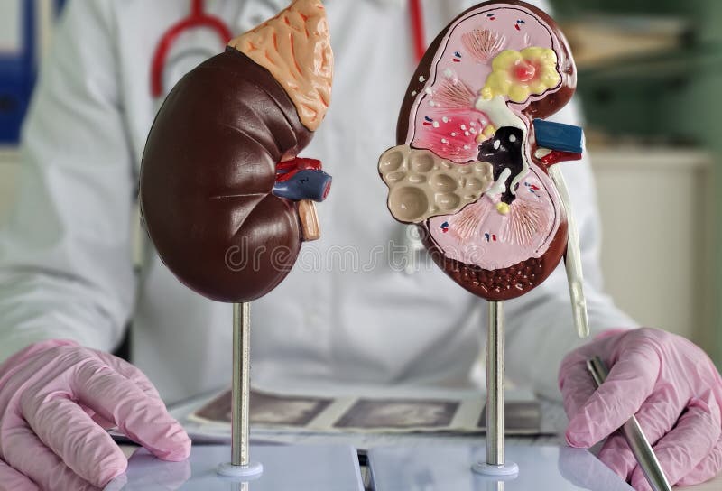 Detailed Anatomical Models Represent Kidney Structures Stock Photo ...