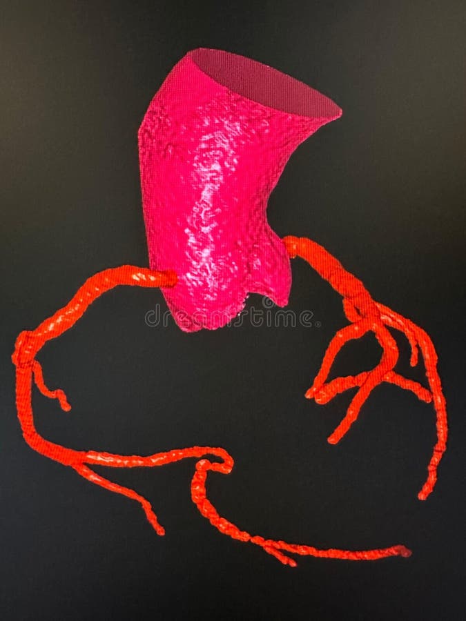 3D Model of Human Aorta and Arteries Stock Photo - Image of design ...