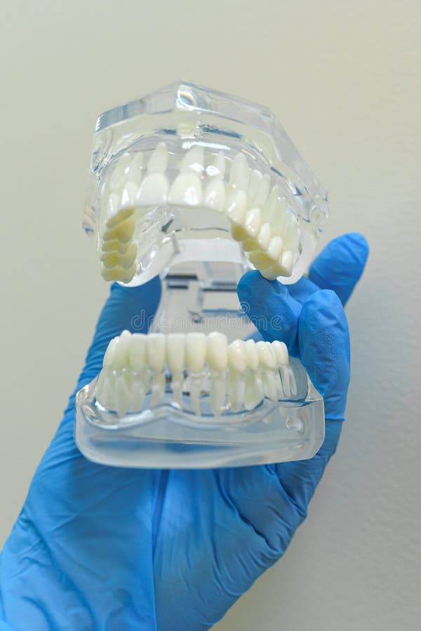 Detailed Dental Model Held in Gloved Hand Showcasing Perfect Tooth ...