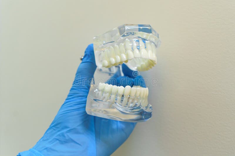 Detailed Dental Model Held in Gloved Hand Showcasing Perfect Tooth ...